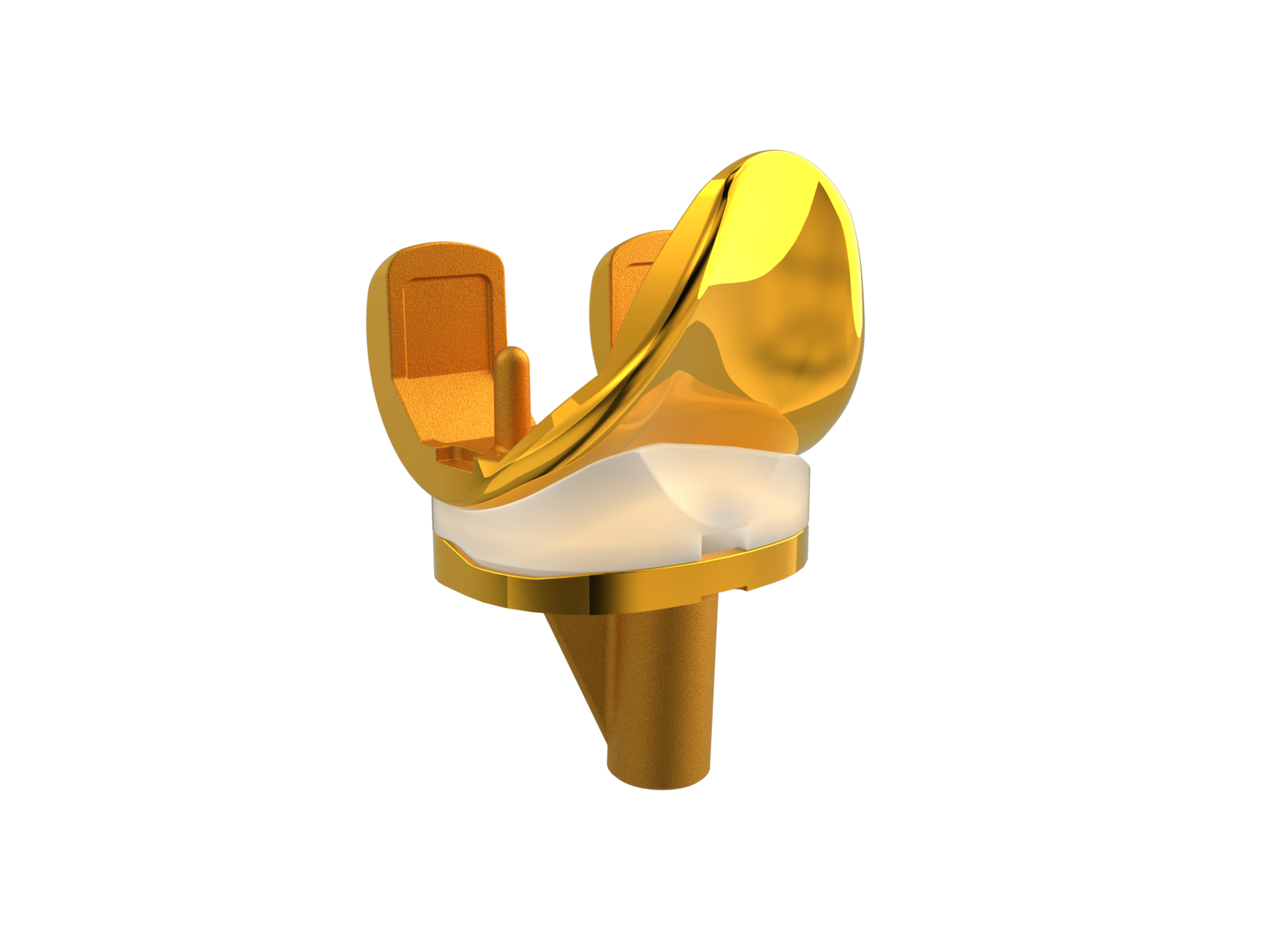 Gold Knee Implants: A silver lining in Total Knee Replacement surgery