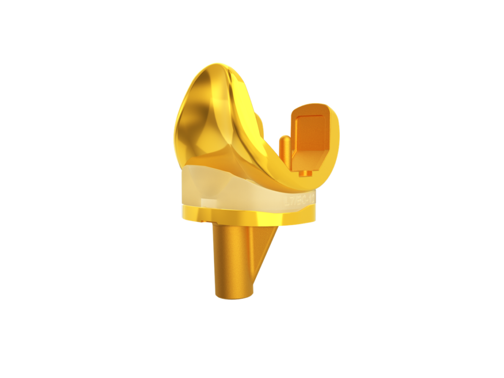 Gold Knee Implants: A silver lining in Total Knee Replacement surgery