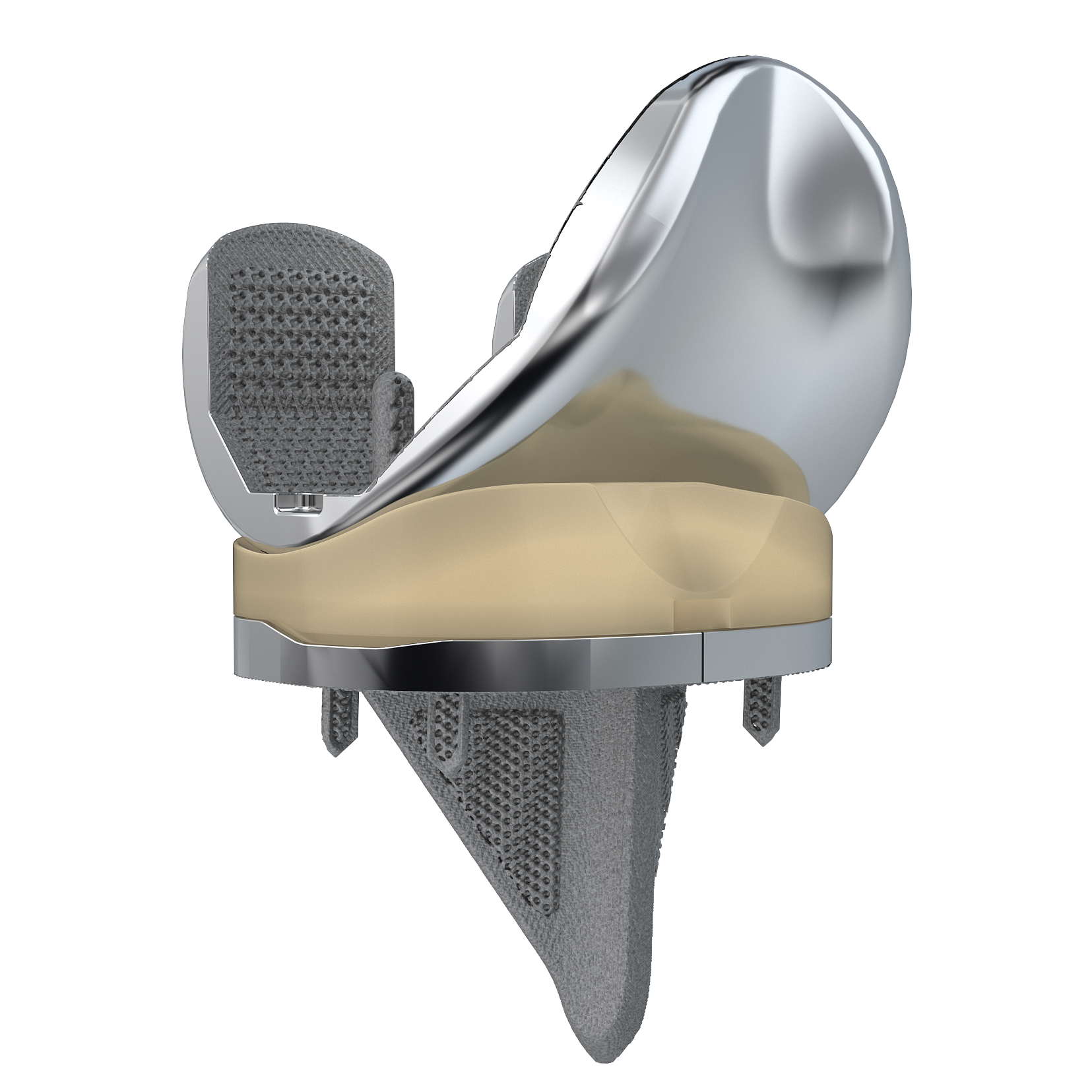 A Pivot Forward: Uncemented Medial Pivot Knee & Robotic TKR